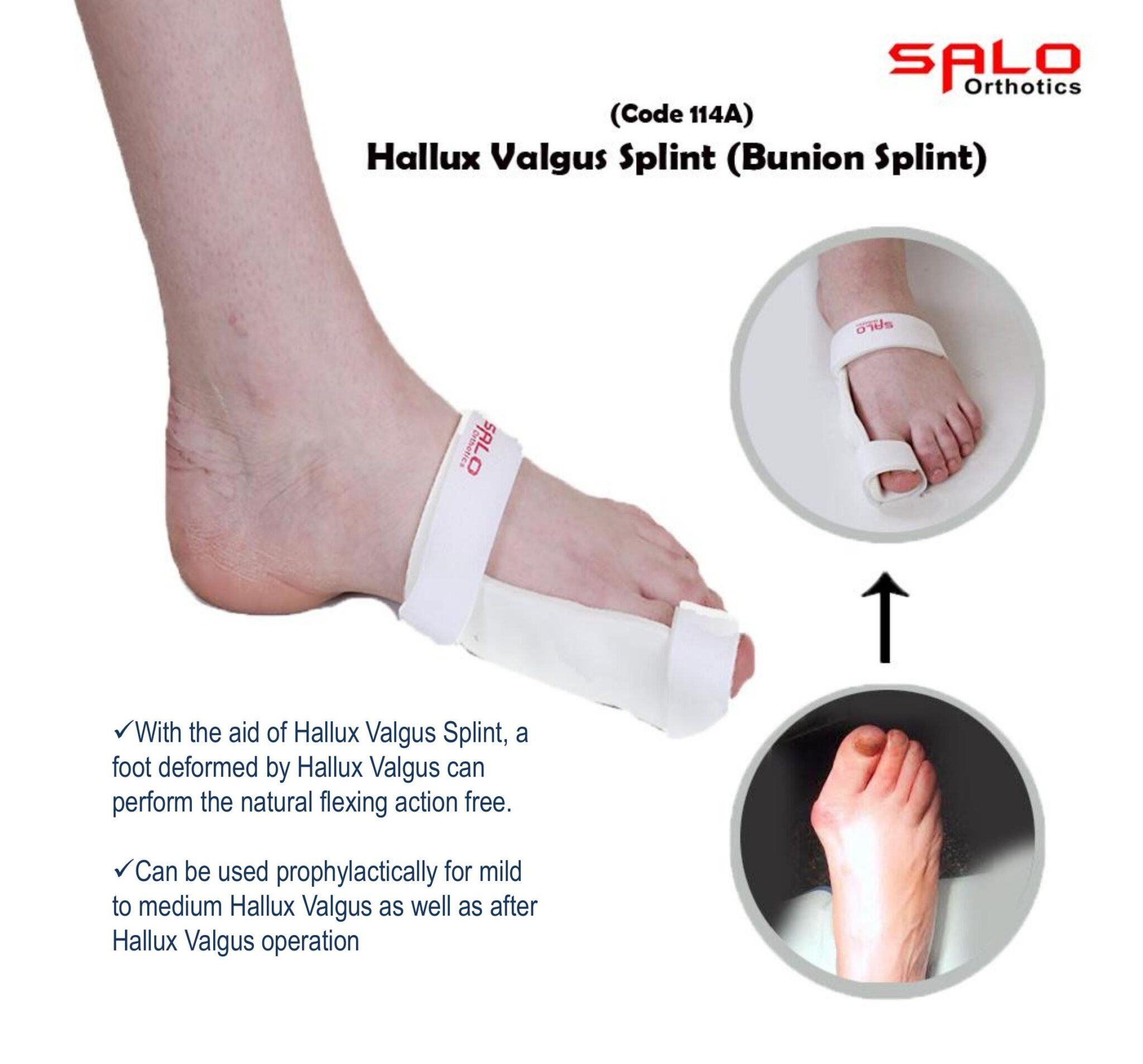 Hallux Valgus Splint (Bunion Splint) - Salo Orthotics