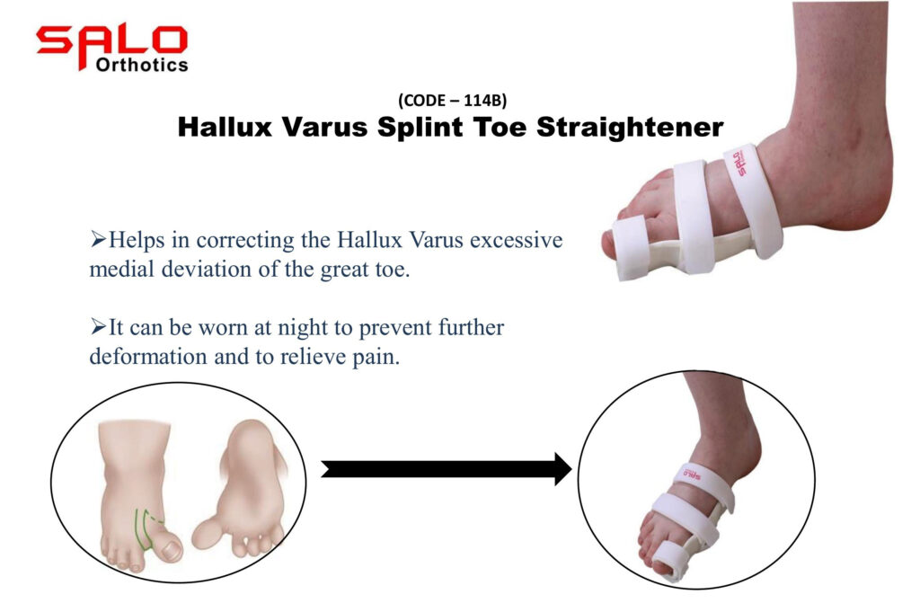Hallux Varus Splint Toe Straightener - Salo Orthotics