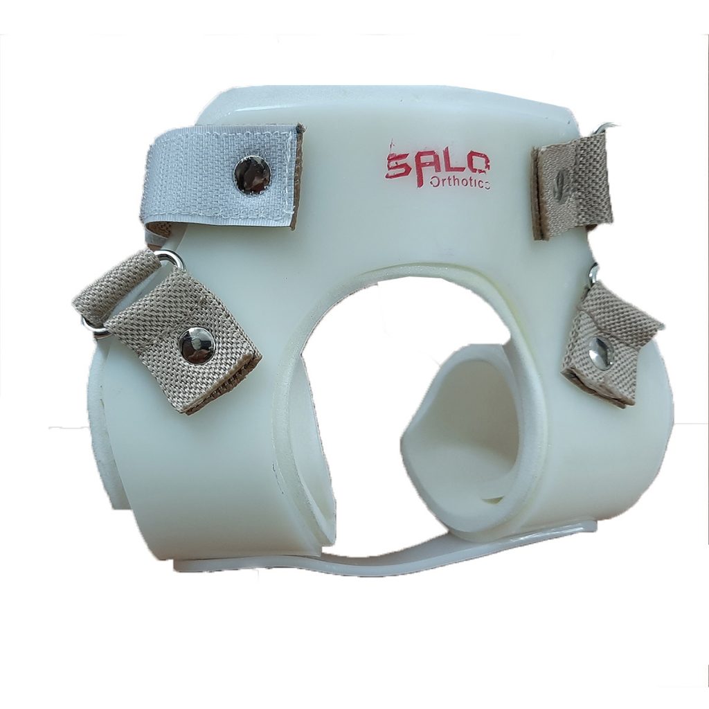 CDH Splint For Congenital Hip Dislocation-Salo Orthotics - Salo Orthotics